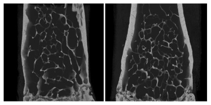 Bones under pressure