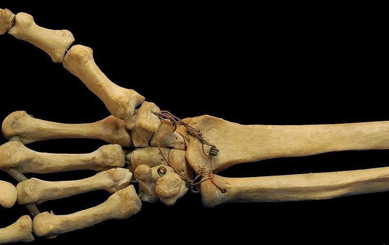How Are Bones Made How Are Bones Made
